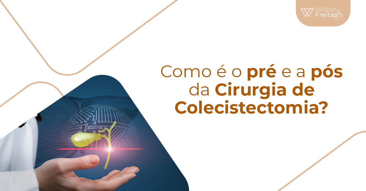 Como é o pré e a pós da Cirurgia de Colecistectomia? - Dr Wilson de ...