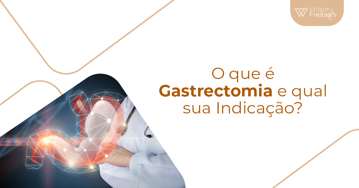 O que é Gastrectomia e qual sua Indicação? - Dr Wilson de Freitas Jr