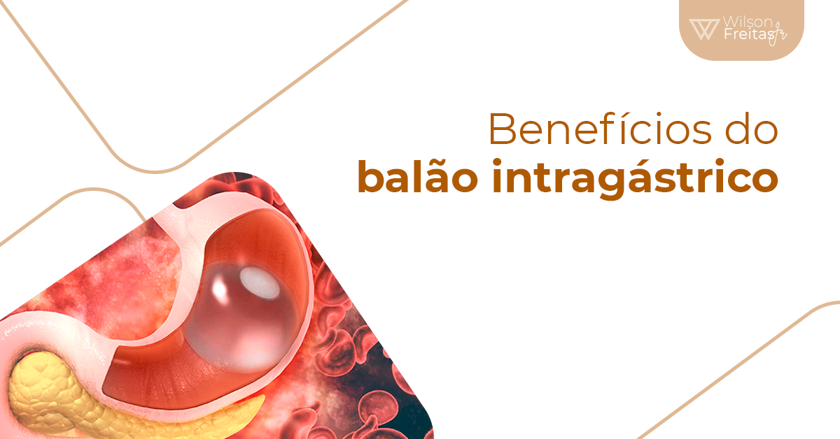 Benefícios do balão intragástrico - Dr Wilson de Freitas Jr