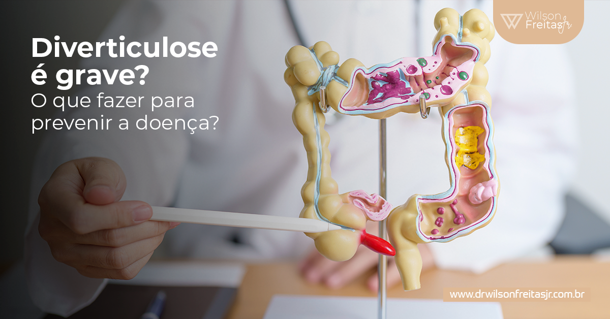 Diverticulose é grave? O que fazer para prevenir a doença? - Dr Wilson ...