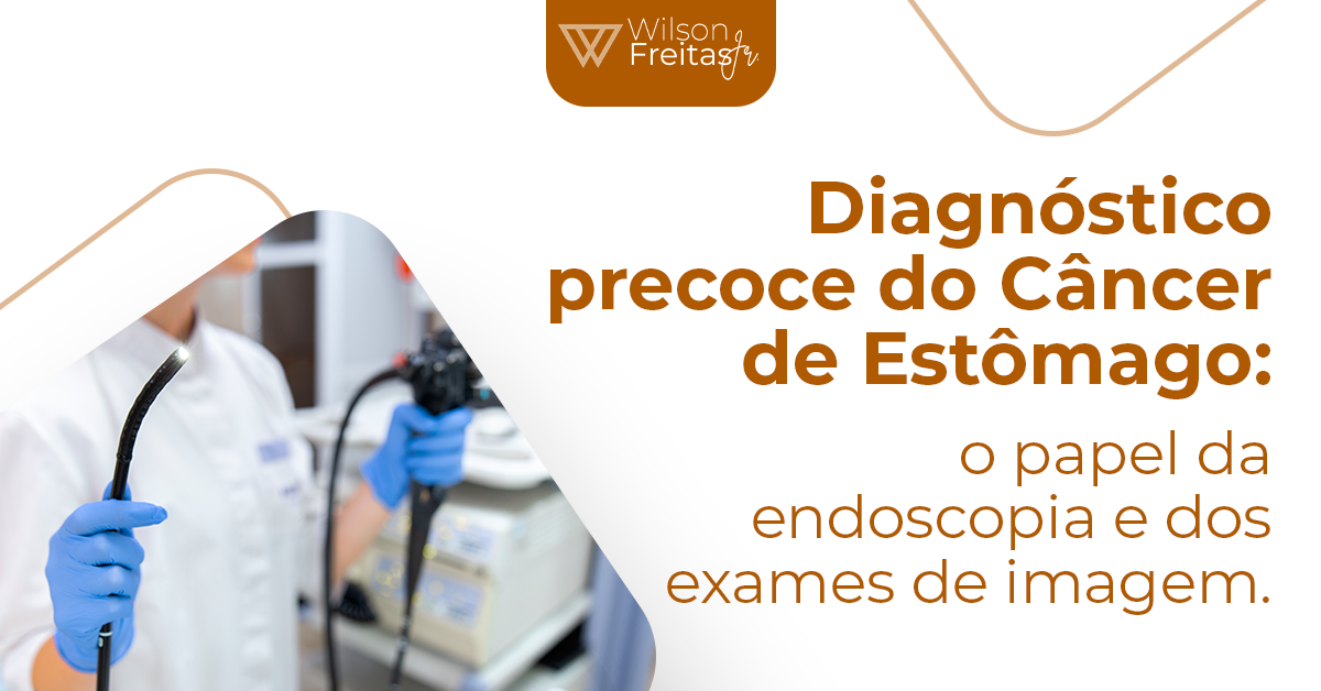 Diagnóstico precoce do Câncer de Estômago: o papel da endoscopia e dos ...